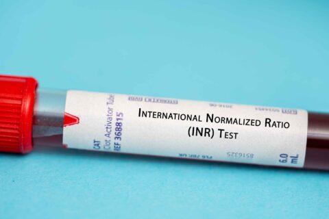 BLOG • Wat is een INR-waarde? - De Nationale Trombose Dienst
